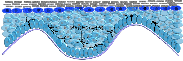 Skin pigmentation - Skin Cancer 909