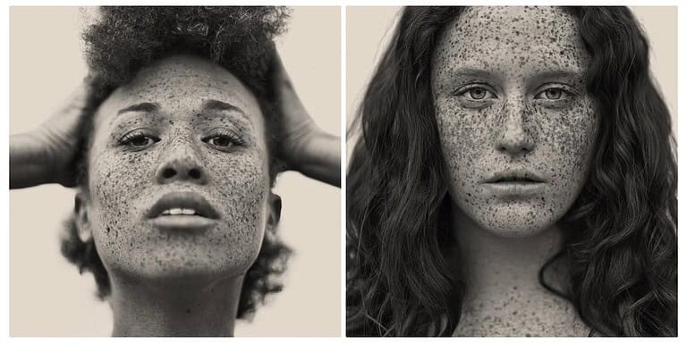 Bench to clinic - Skin Cancer 909